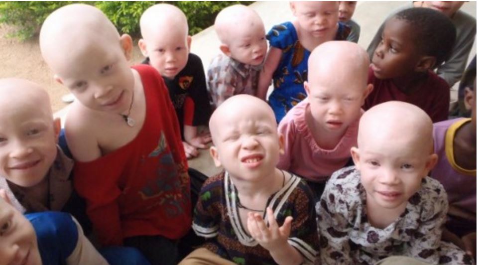 Albinos - Journal de Brazza